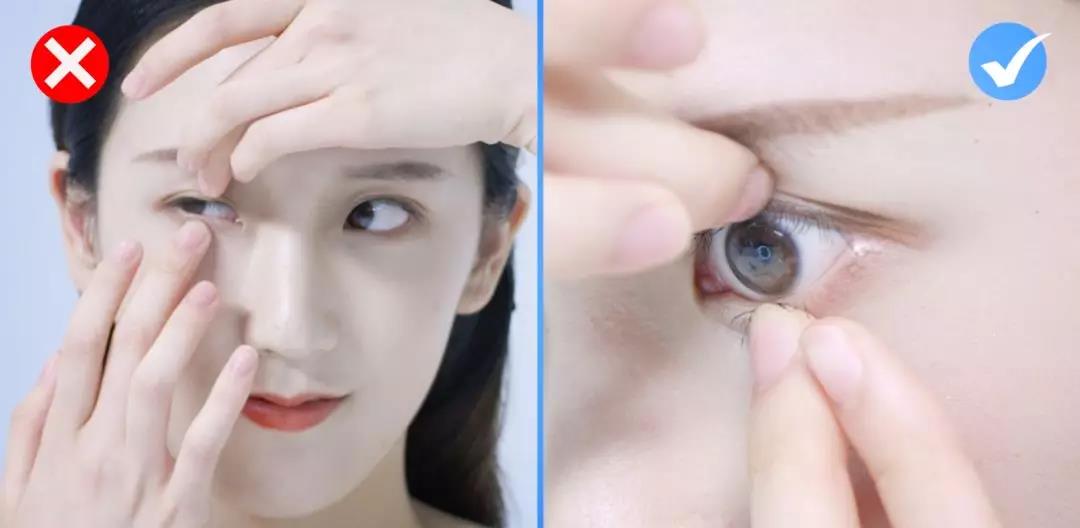 小助手攻略丨超详细OK镜、RGP隐形眼镜摘镜视频来了！ - 目立康Menicon（美尼康）官网